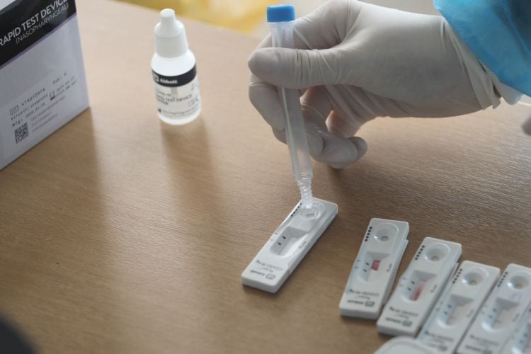 Δήμος Λαρισαίων: Το εβδομαδιαίο πρόγραμμα διεξαγωγής rapid test - ΚΕΔΕ