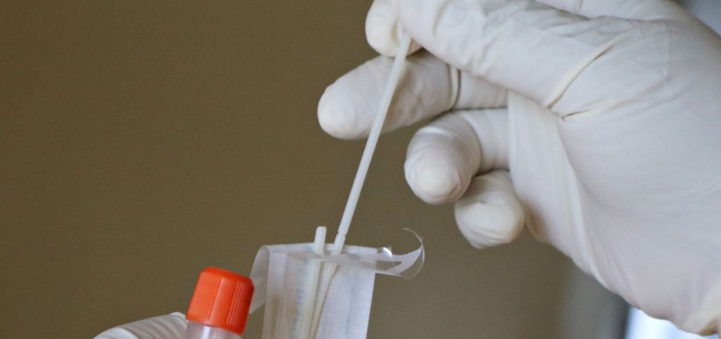 Δωρεάν Rapid Tests στο Δημαρχείο Περιστερίου και το Δεκέμβριο - ΚΕΔΕ